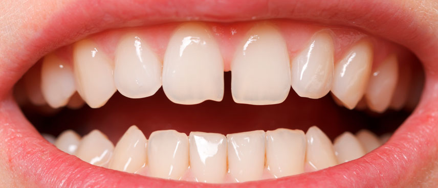 Descubre las CURIOSIDADES de los DIENTES que NO SABÍAS